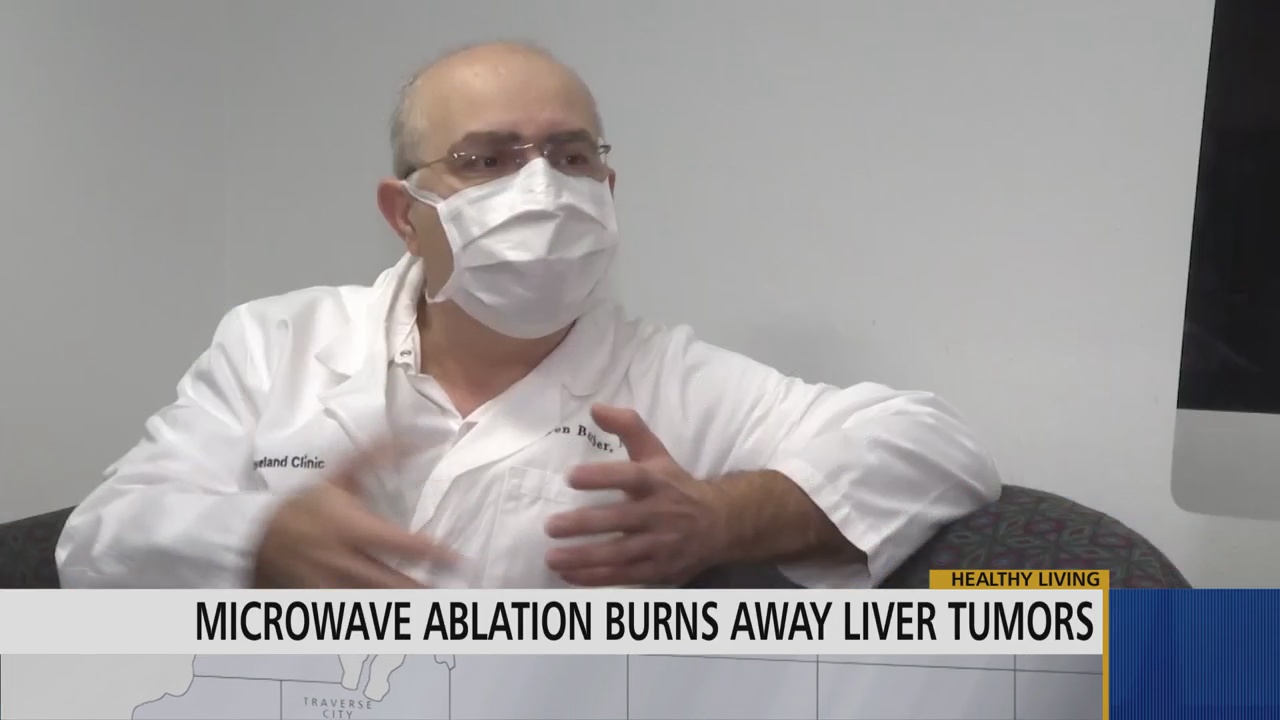 Healthy Living: Microwave Ablation Burns Away Liver Tumors – 9&10 News