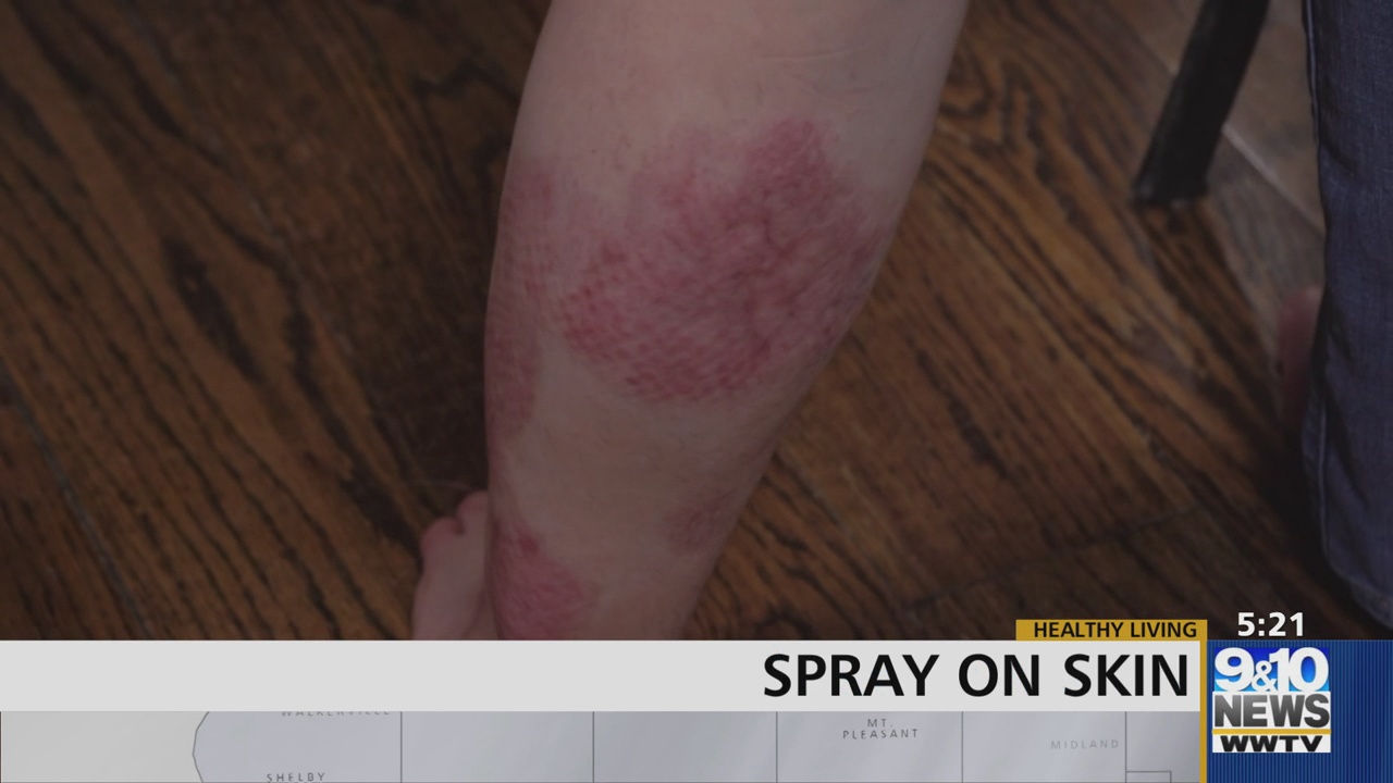 Healthy Living: Spray On Skin – 9&10 News