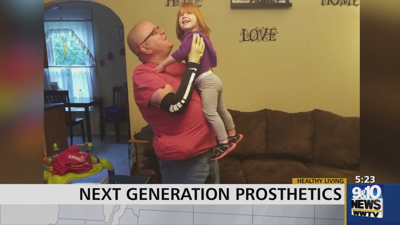 Healthy Living: Next Generation Prosthetics – 9&10 News