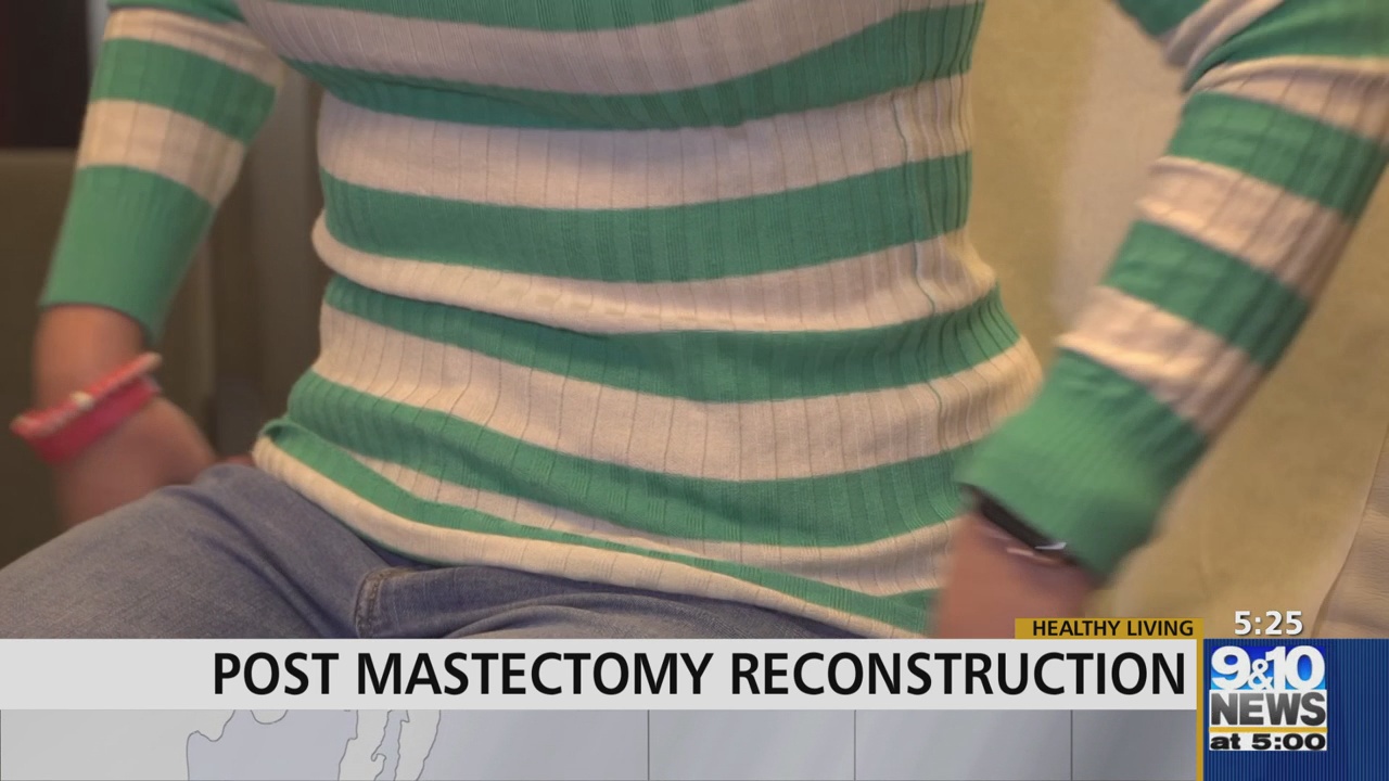 Healthy Living: Post Mastectomy Reconstruction – 9&10 News
