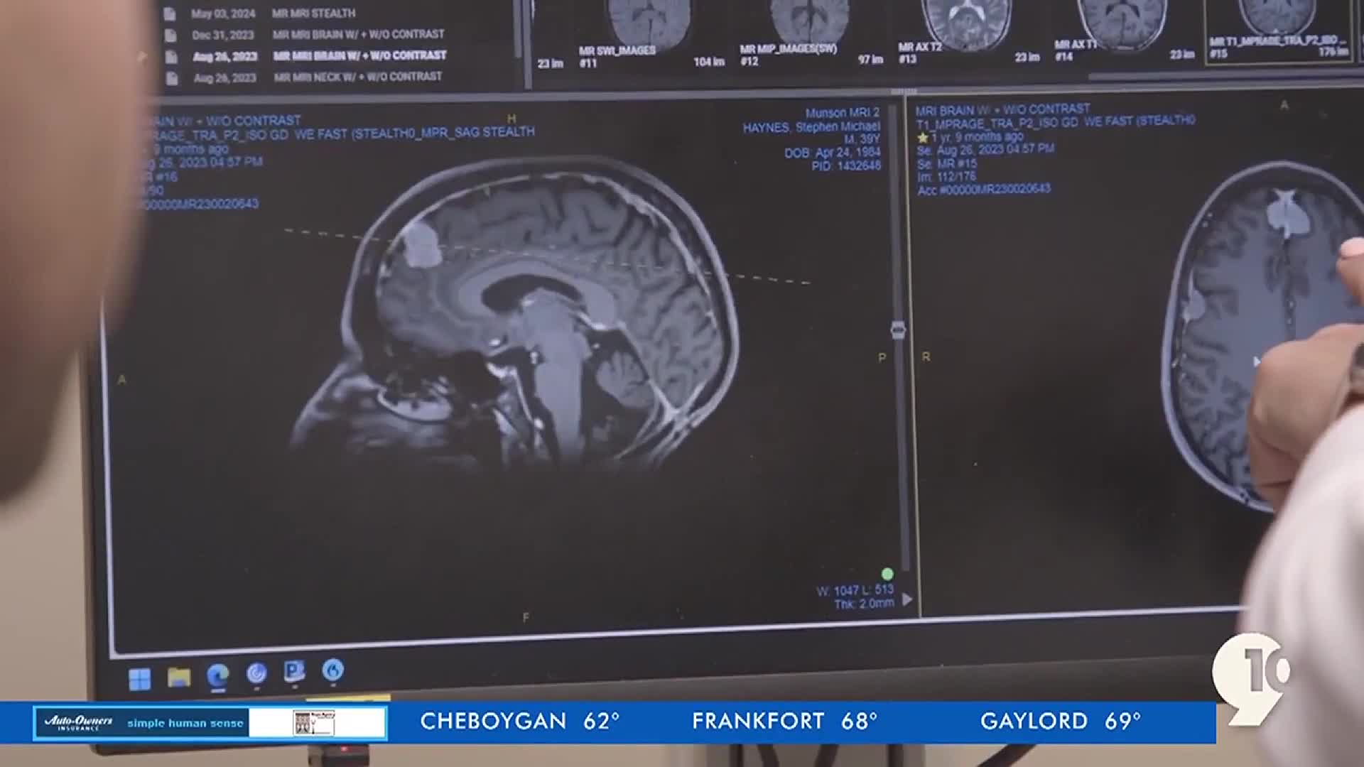 Brain tumor survivor shares his journey and spreads hope for others ...