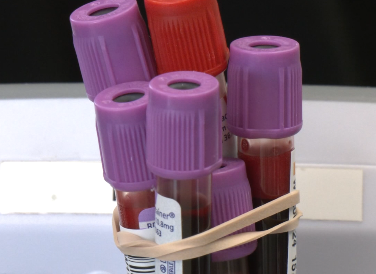 Versiti Blood Center, desperately low on blood, asks for the public to ...