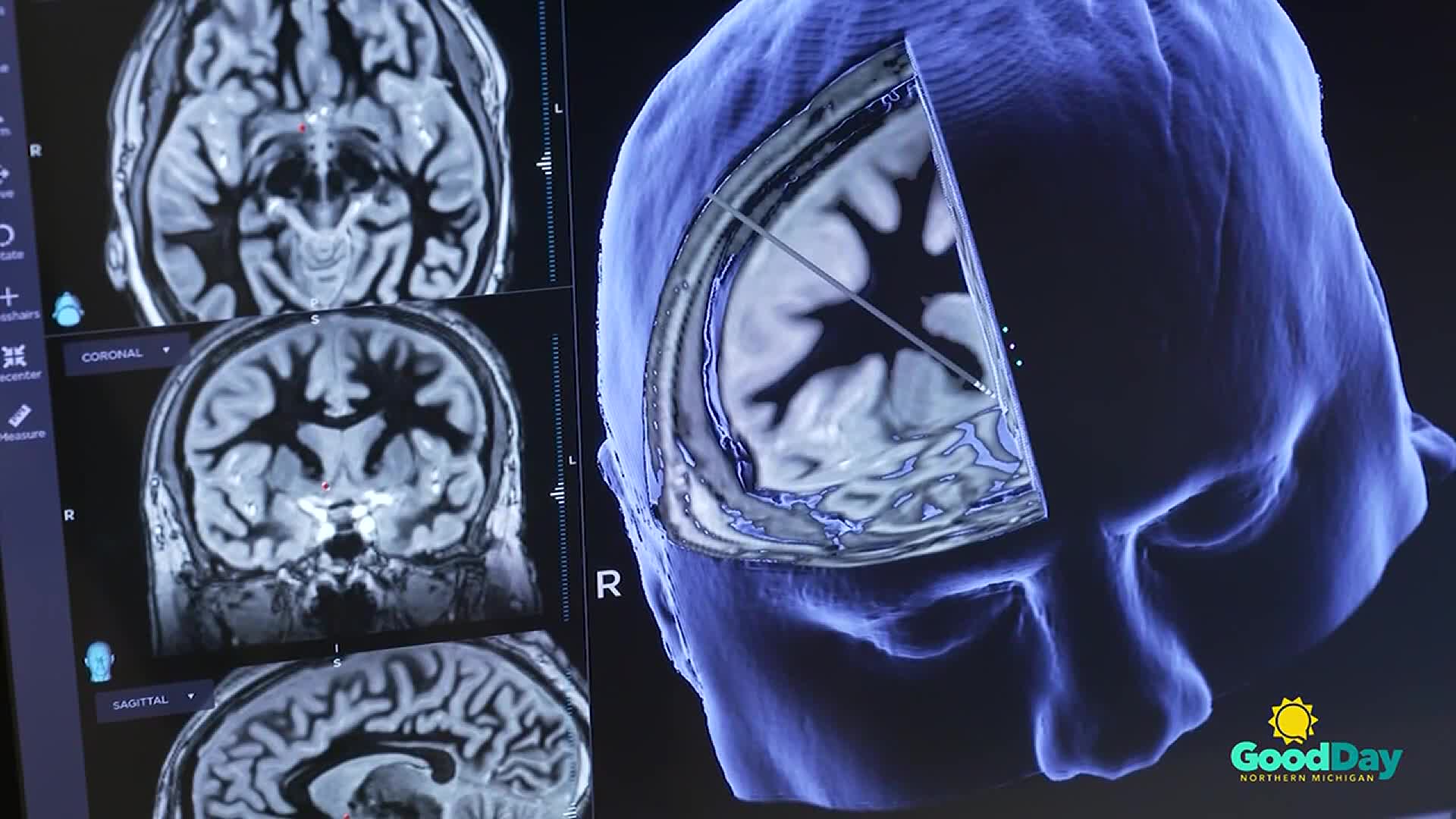 Dr. Amanda Porter on importance of Alzheimer's Awareness Month ...